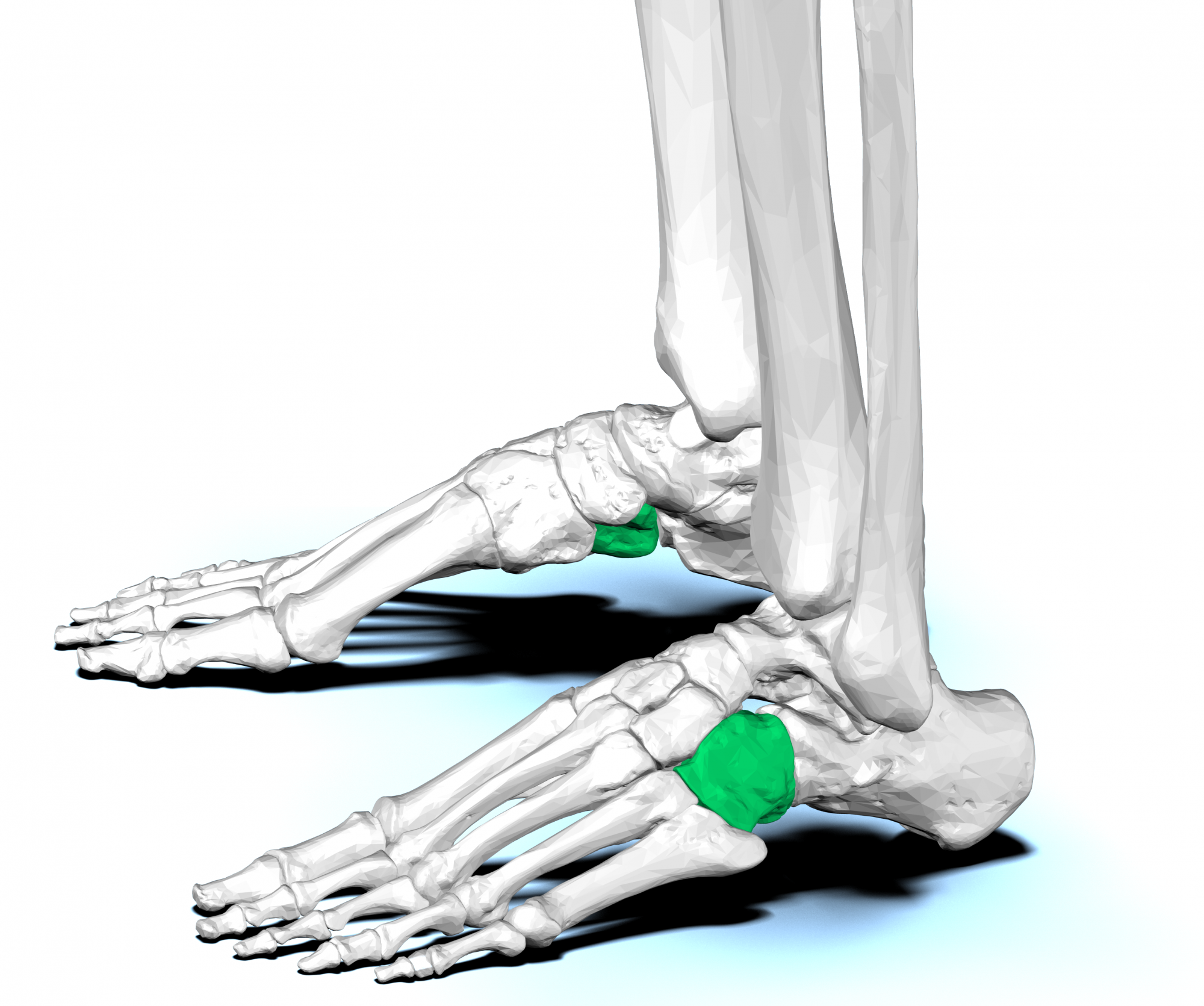 Ayağın Dış Kısmında Ağrı - Kuboid Sendromu - Doktor Fizik